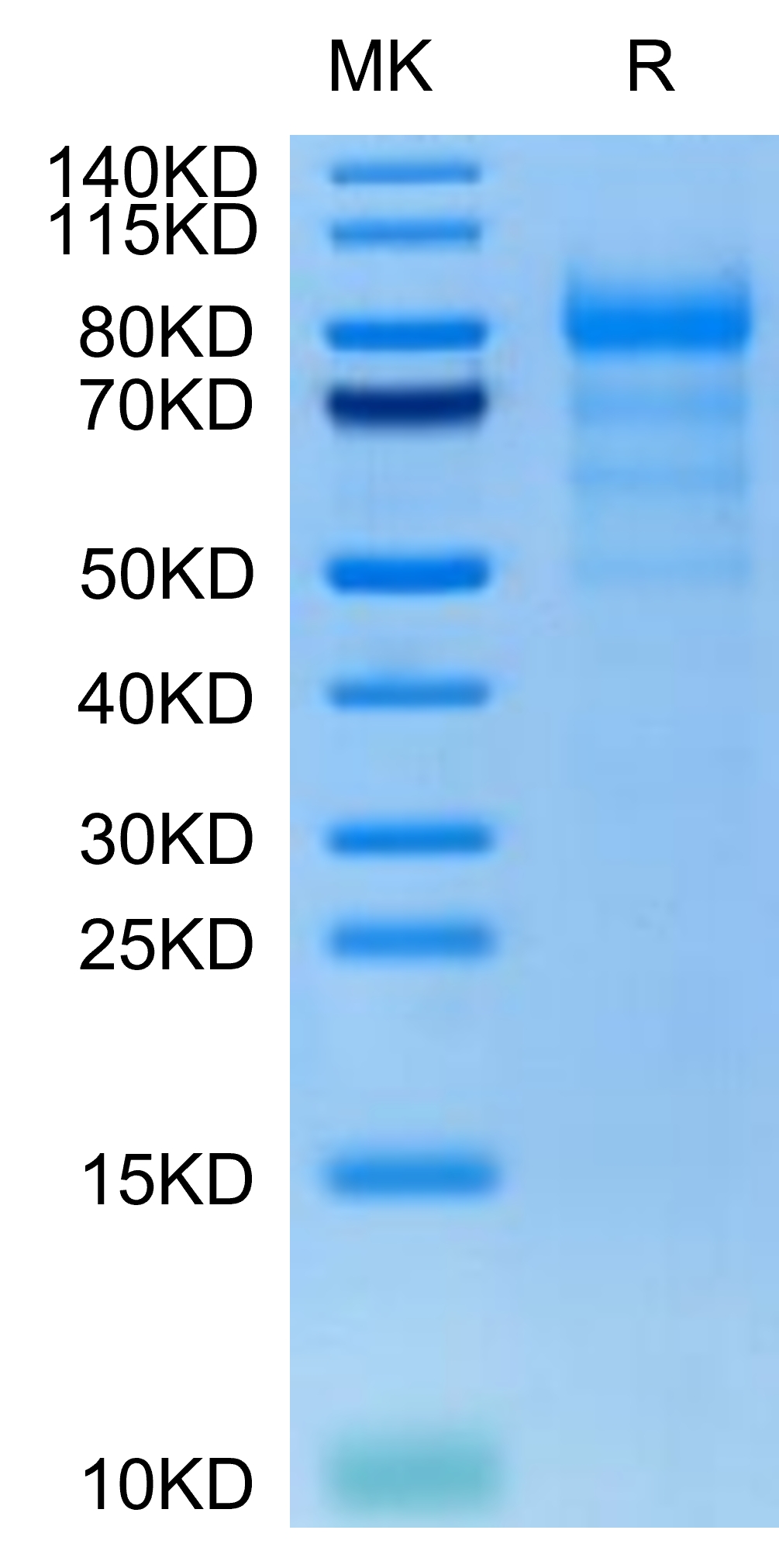 Human CDH6/Cadherin-6 Protein, Accession: P55285 - 江苏沃尔森生物科技有限公司