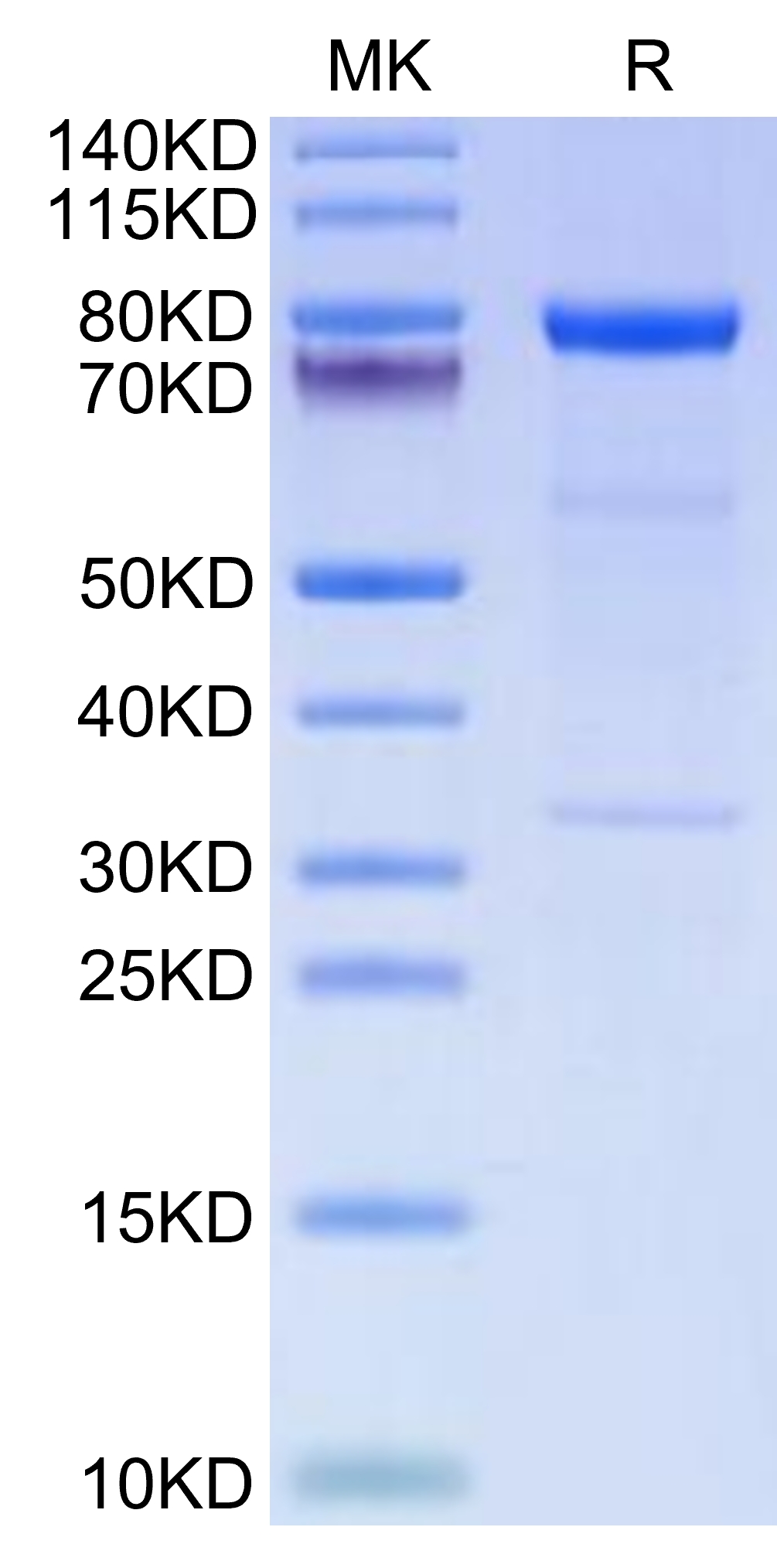 Human Complement Component C1s Protein, Accession: P09871 - 江苏沃尔森生物科技有限公司